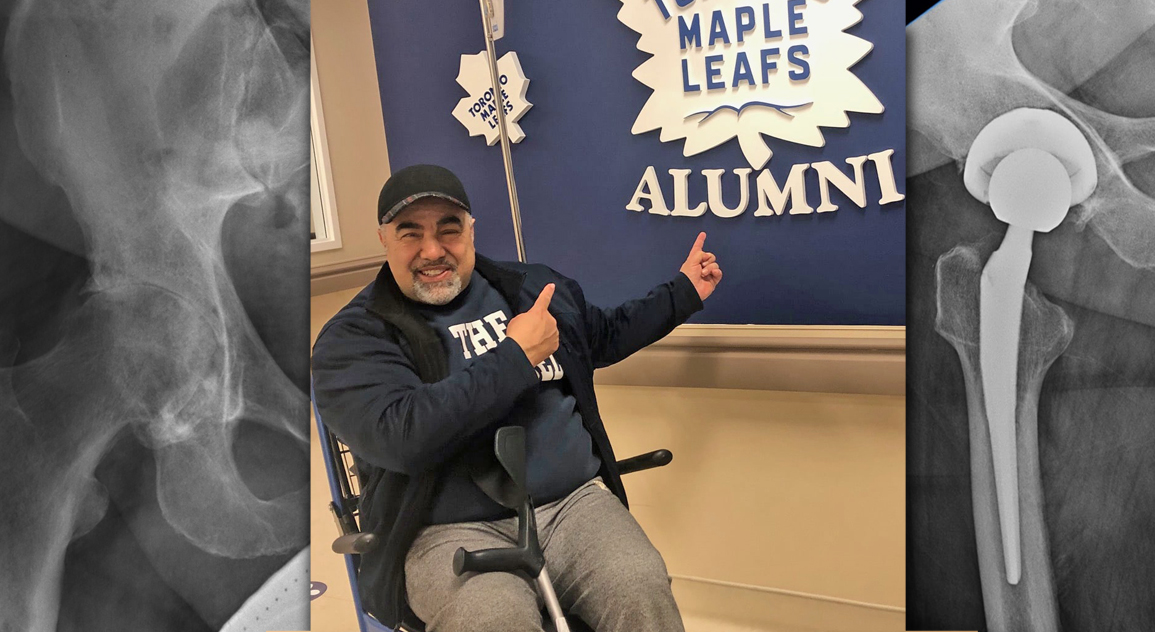 My robotic hip replacement in Canada - Toronto Times